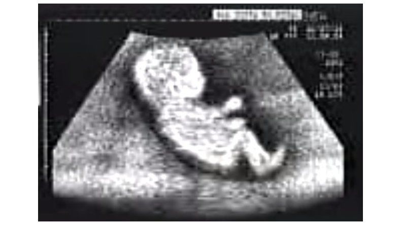 Mujer de 92 años tuvo un embarazo de cinco décadas