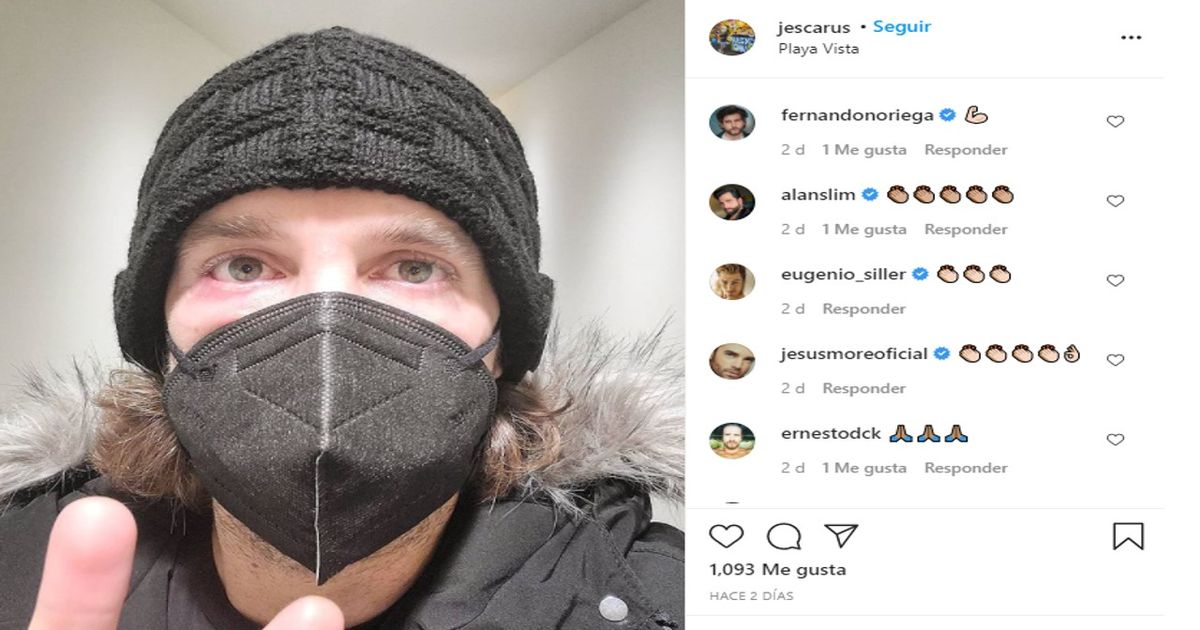 Actor Jesús Carús supera el cáncer de piel en un ojo