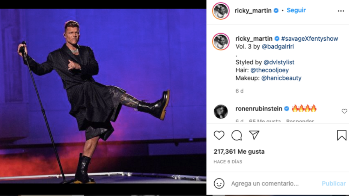Ricky Martin sorprende con sus arreglos faciales