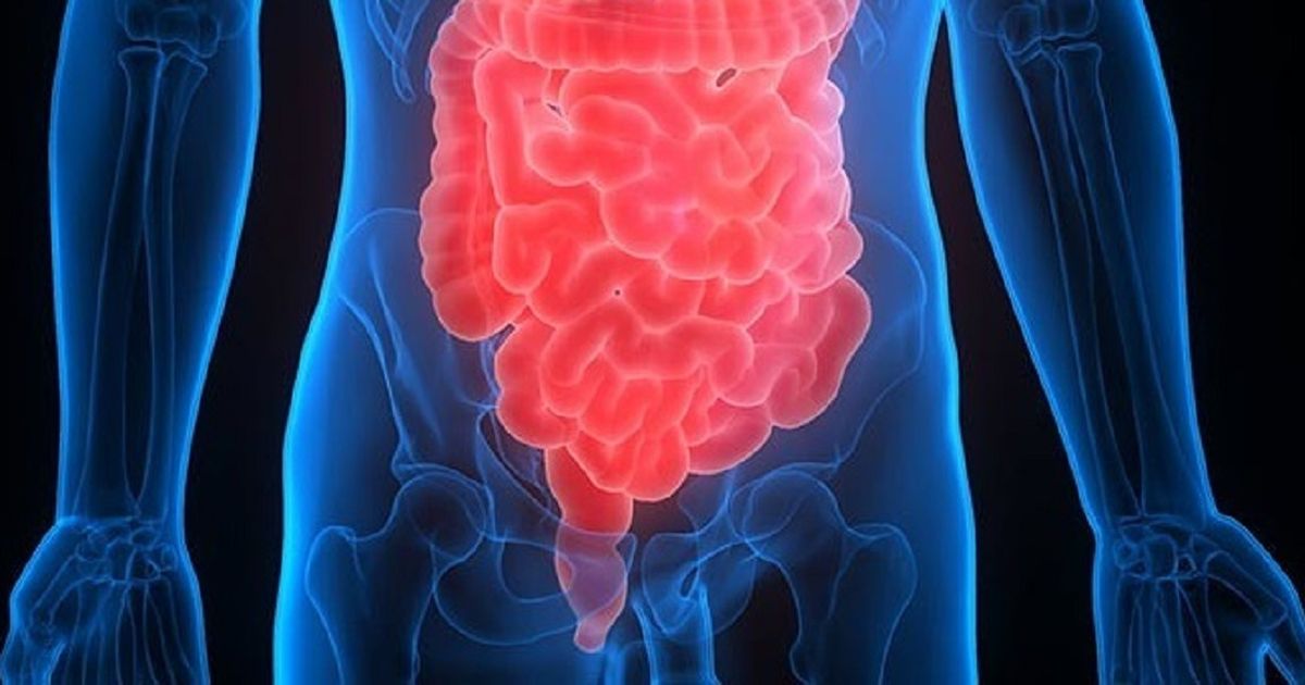 El cáncer de colon puede prevenirse con un sano estilo de vida