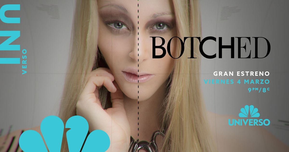 Universo lanza en español las series Botched y Snapped