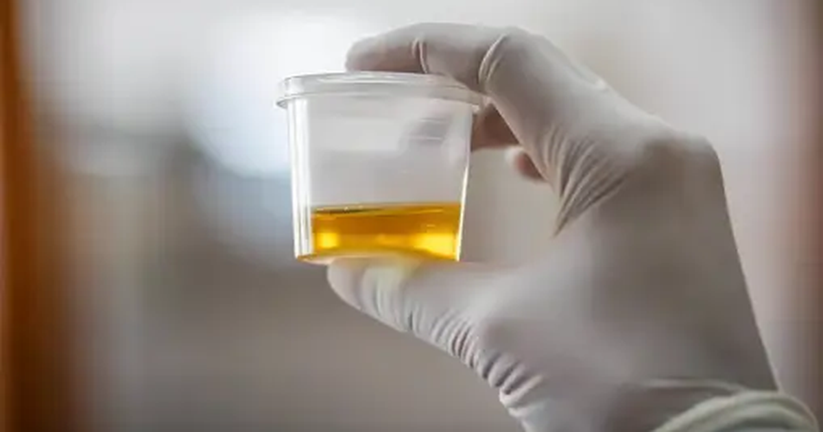 Científicos revelan la razón del color amarillo en la orina