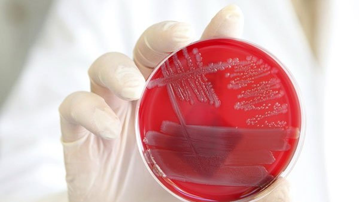 La bacteria E. Coli, la causa más frecuente de infección urinaria
