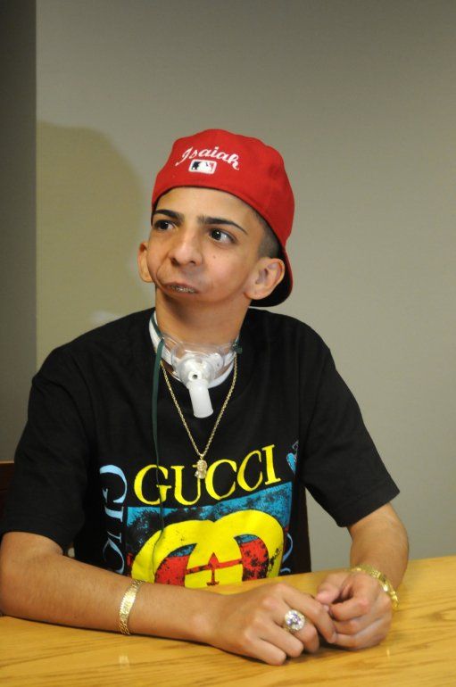 Joven sin mandíbula que escribe rap es nominado en premios para ...