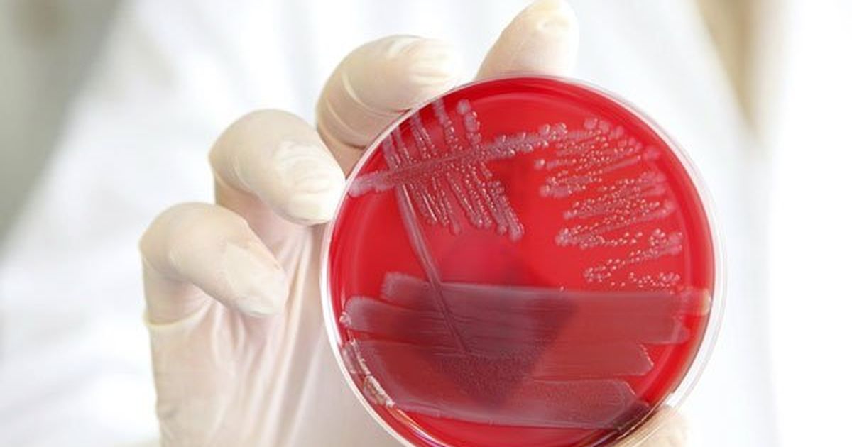 La bacteria E. Coli, la causa más frecuente de infección urinaria